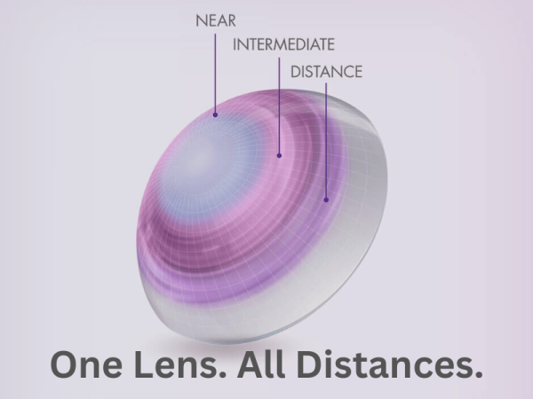 Top 5 Best Contact Lenses For Dry Eyes Of 2024