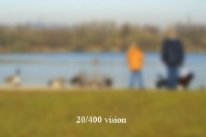 How Bad Is My Eye Prescription? Decoded In 3 Steps